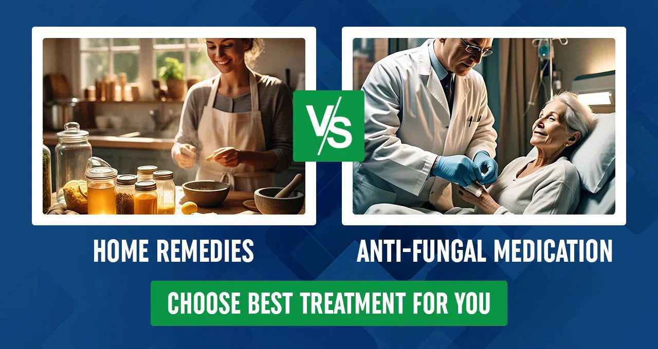 Home Remedies vs. Anti-Fungal Medication: Best Treatment for You ...